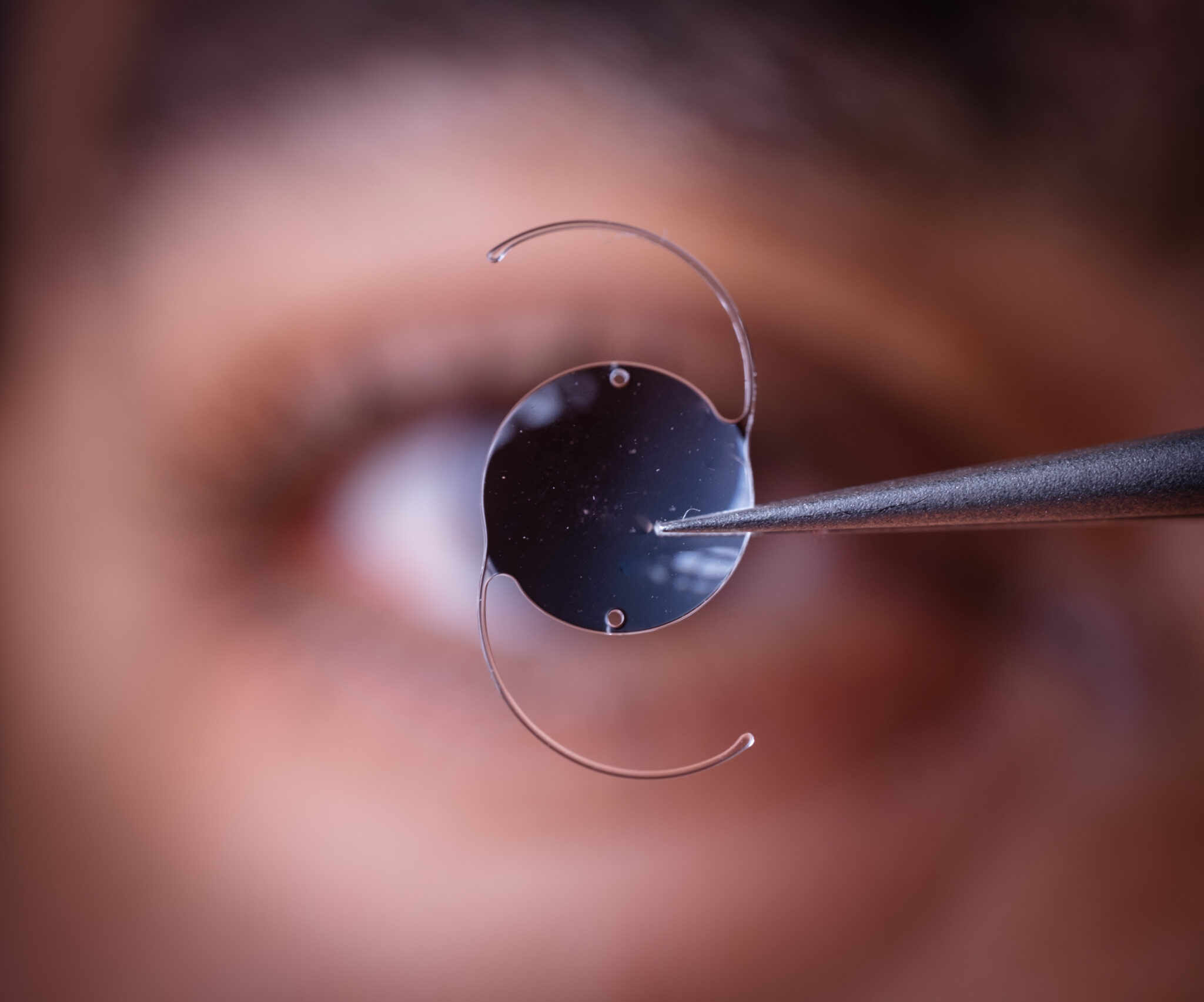 The History of LASIK Eye Surgery? | LASIK.com